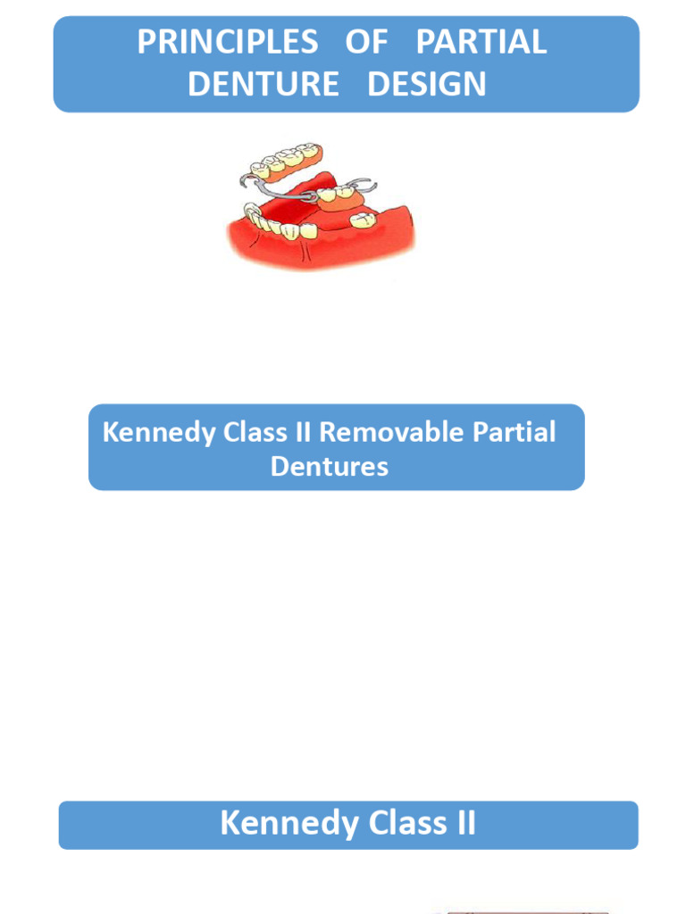 Kennedy Class II III RPD 2024 | PDF | Dentures | Medical Specialties