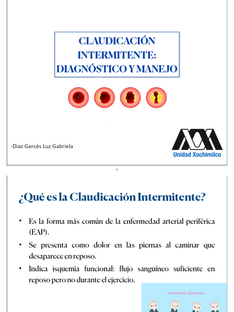 Claudicacion Intermitente Presentacion Estilizada | PDF | Medicina ...