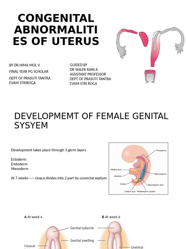 Congenital Abnormalities of Uterus | PDF | Uterus | Reproductive System