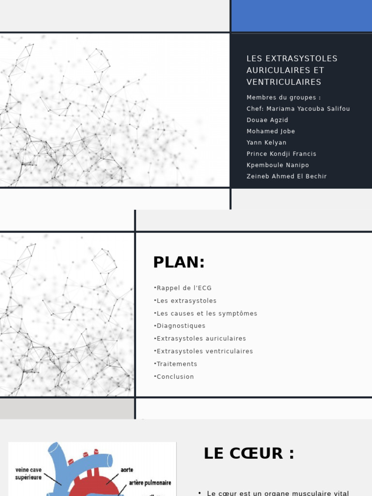 Extrasystoles : Types, Causes et Traitements | PDF ...