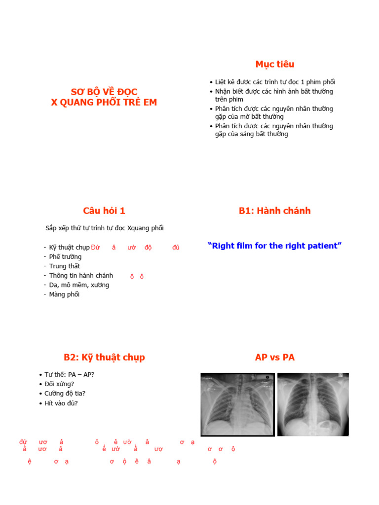 Chest Xray | PDF