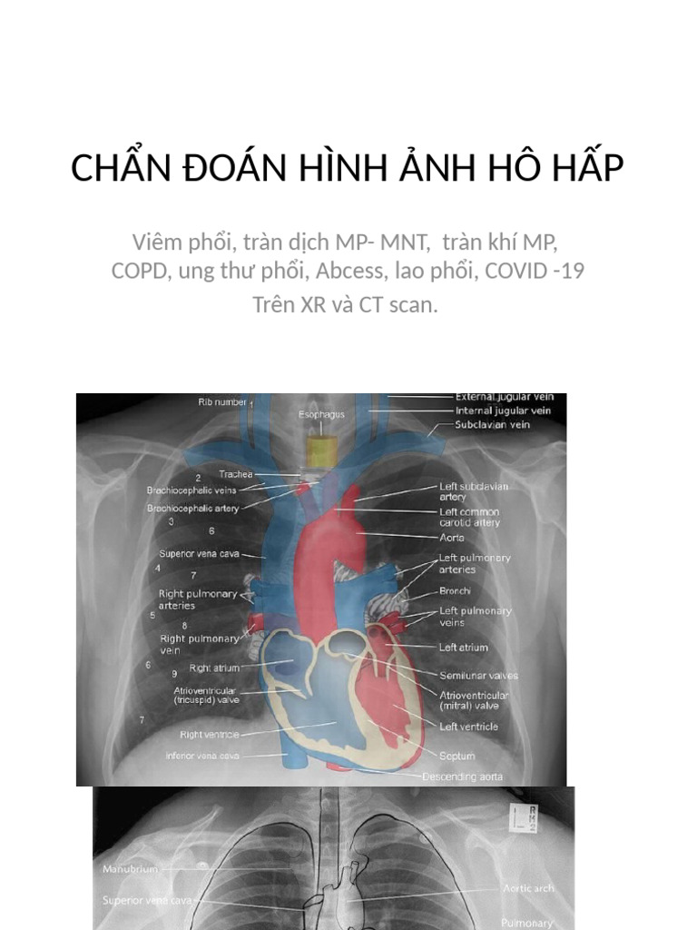 Chan Doan Hinh Anh Ho Hap | PDF