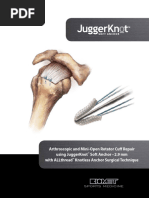 T2 Proximal Humeral Nailing System - Stryker | PDF | Screw | Orthopedic ...