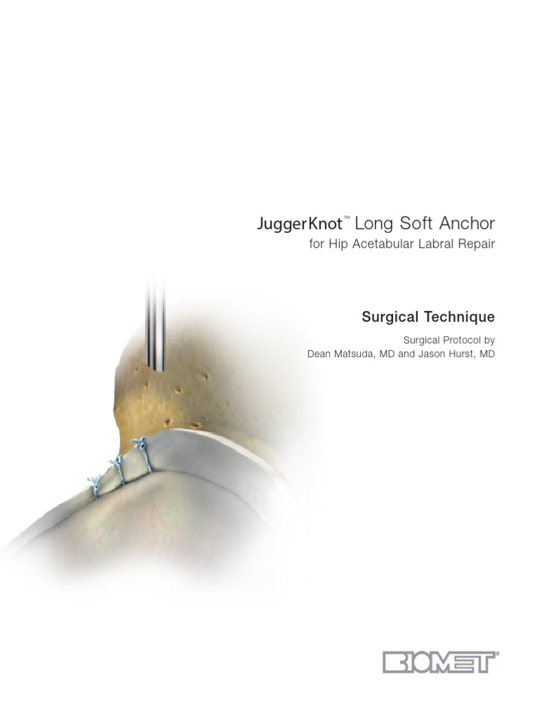 JuggerKnot™ Long Soft Anchor | PDF | Joints | Limbs (Anatomy)