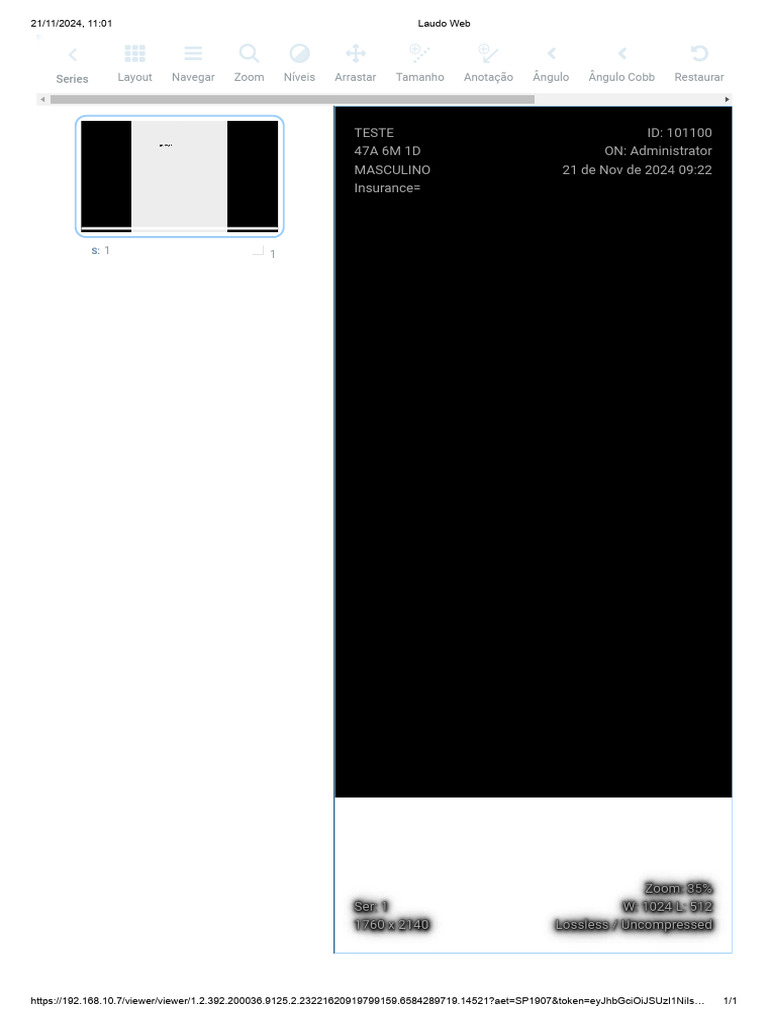 Teste Imagem RX | PDF