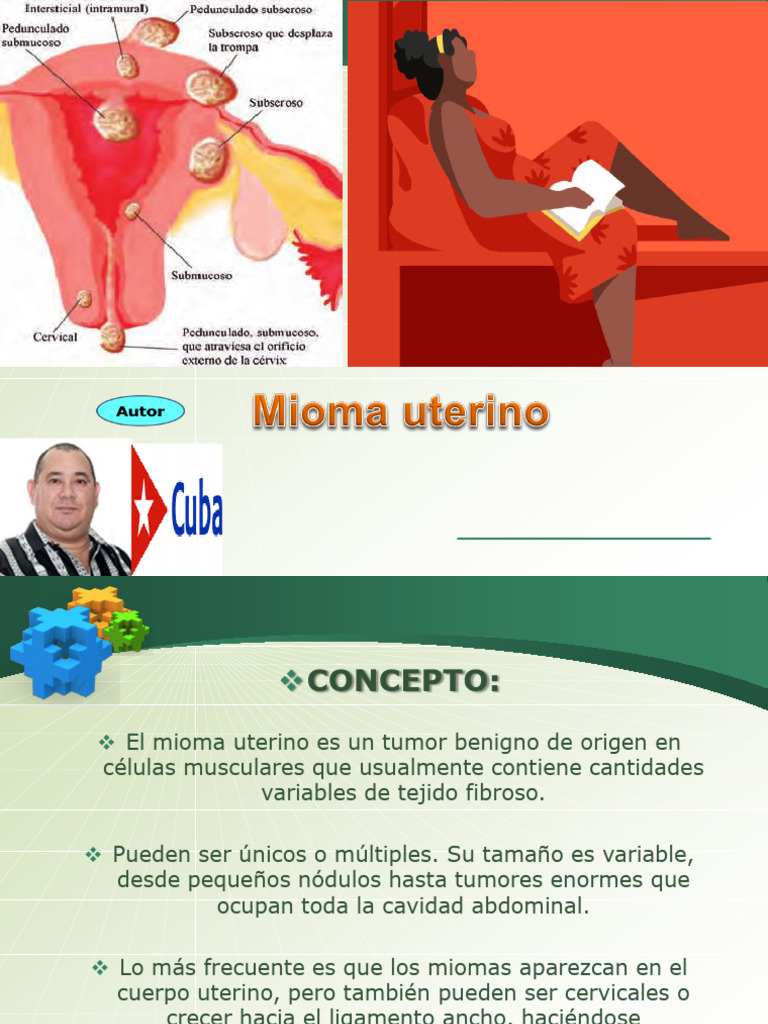 CLASE 16.2 Mioma Uterino | PDF | El embarazo | Parto