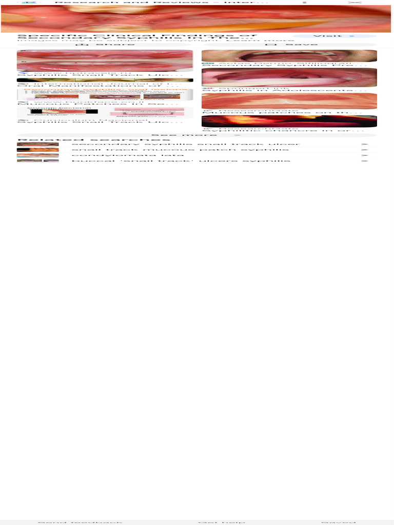 Snail Track Ulcer Syphilis - Google Search | PDF