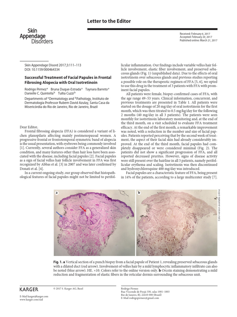 Isotretinoin for Facial Papules in FFA | PDF | Hair Loss | Medical ...