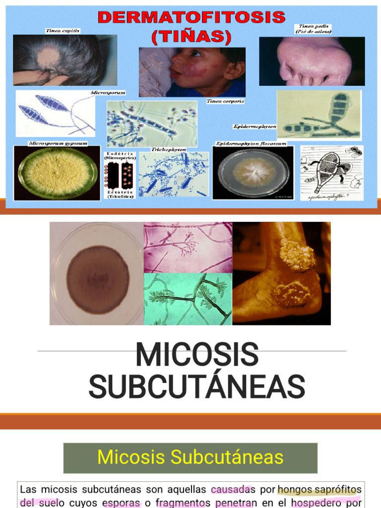 Micosis Subcutáneas y Esporotricosis | PDF | Candidiasis ...