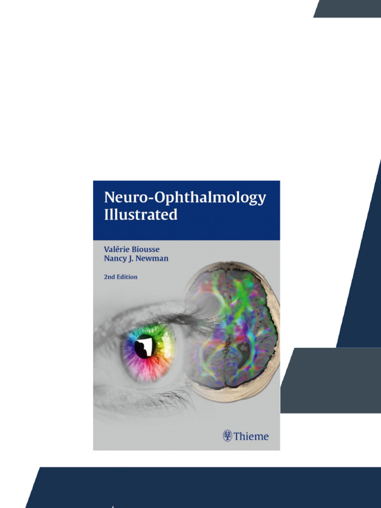 Neuro Ophthalmology Illustrated 2nd Edition Instant Download | PDF
