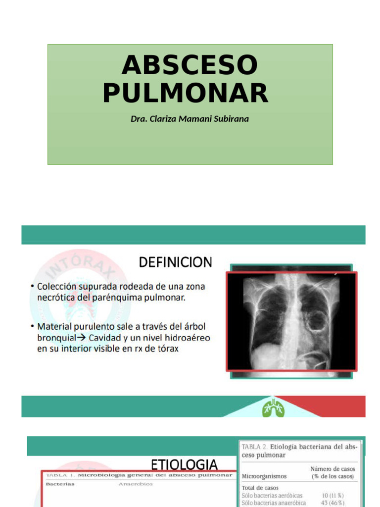 Absceso Pulmonar | PDF