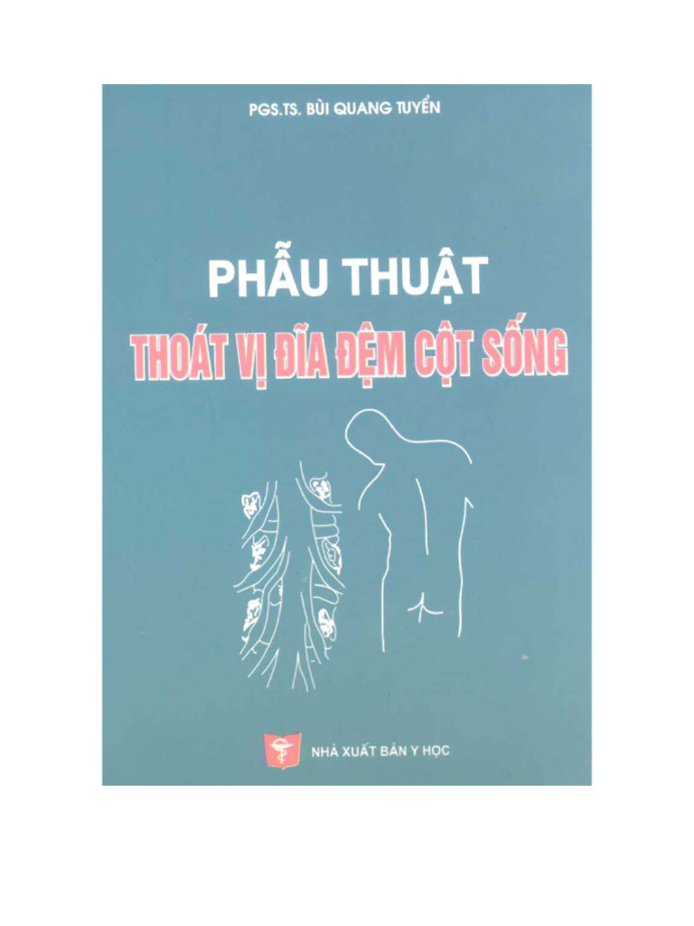 Phau Thuat Thoat Vi Dia Dem | PDF