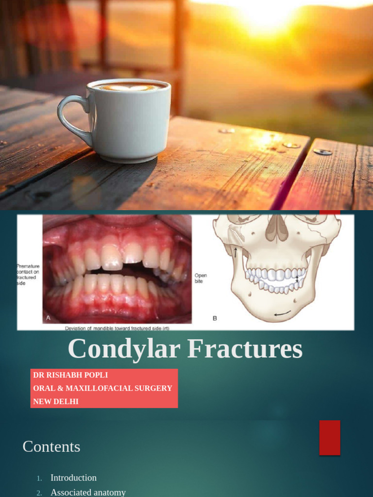 Condylar Fractures: Surgical Insights | PDF | Ct Scan | Human Anatomy
