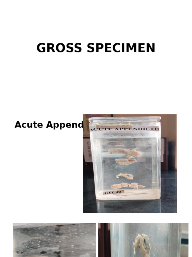 Gross Specimen | PDF