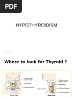 ATA Guidelines for Hypothyroidism | PDF | Hypothyroidism | Thyroid ...