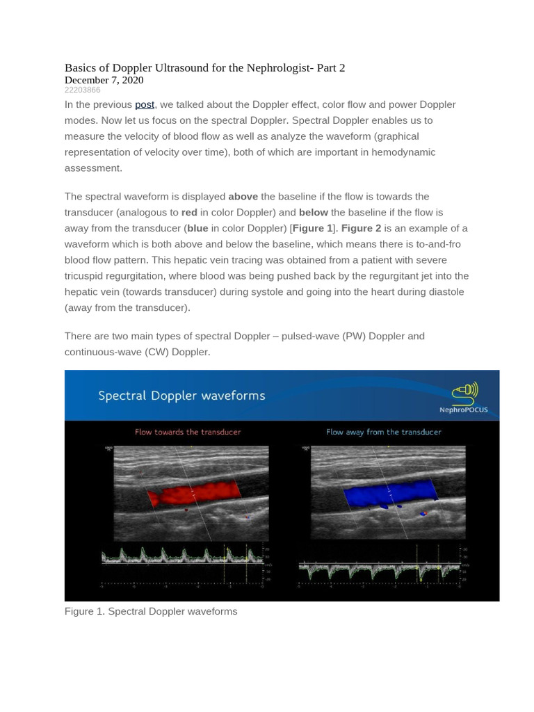 Understanding To-and-Fro Doppler Waveforms | PDF | Cardiovascular System