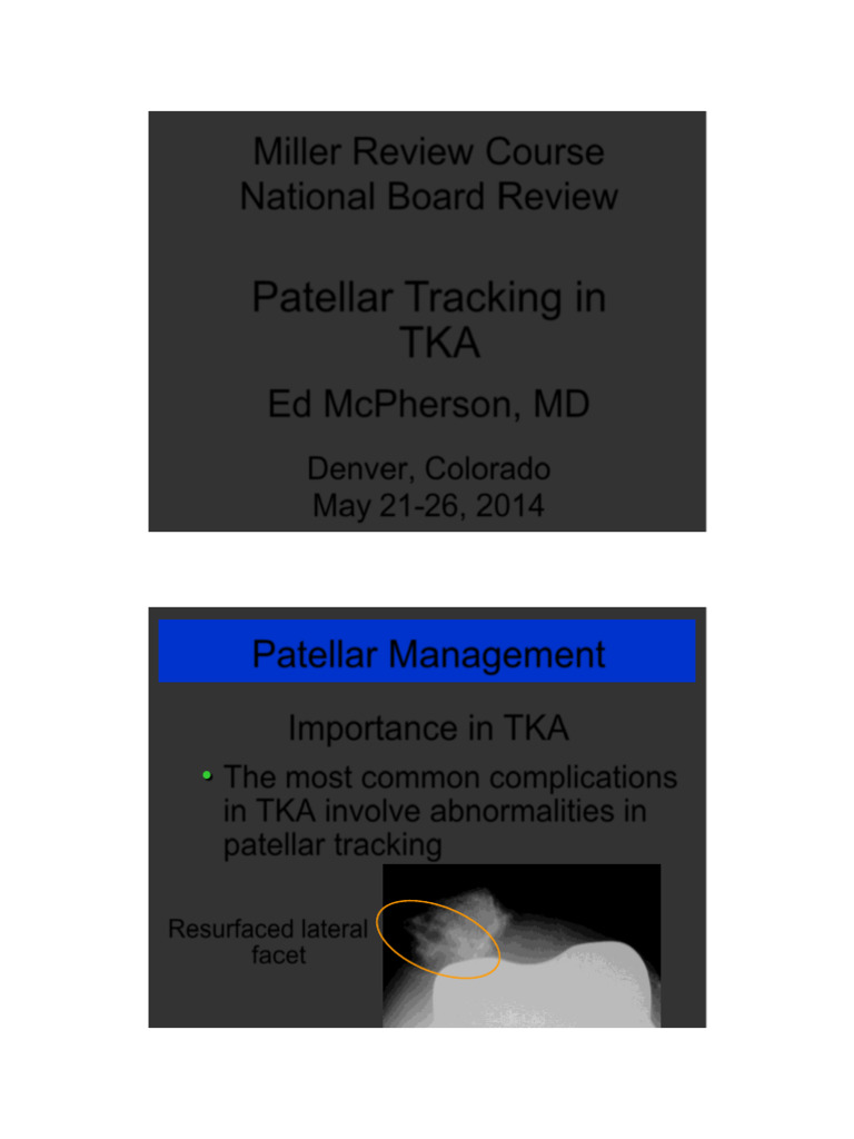 McPherson Adult Recon - 3 Patella TKA | PDF | Knee | Musculoskeletal System