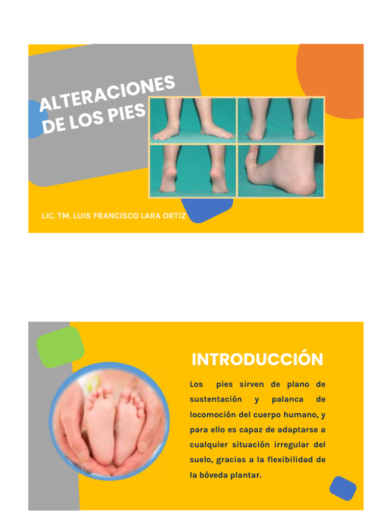 Alteraciones de Los Pies PDF | PDF | Pie | Sistema musculoesquelético