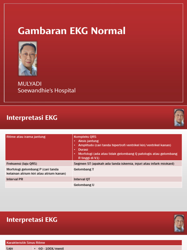 3.1 - Gambaran EKG Normal - Mulyadi | PDF