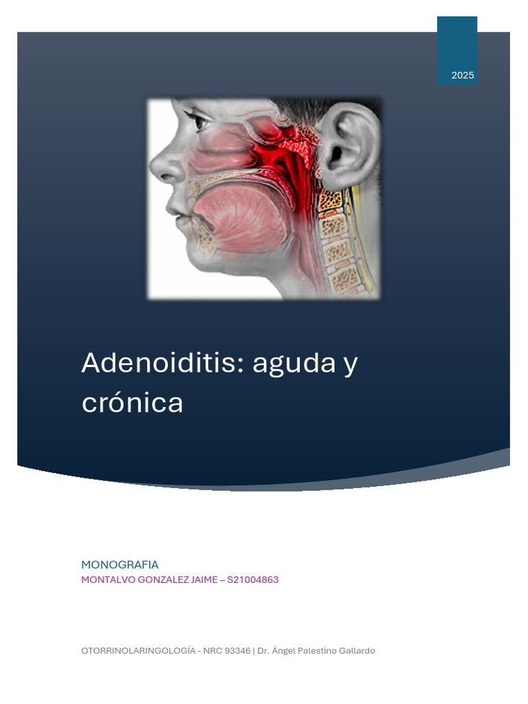 Adenoiditis Monografia | PDF | Alergia | Inmunología