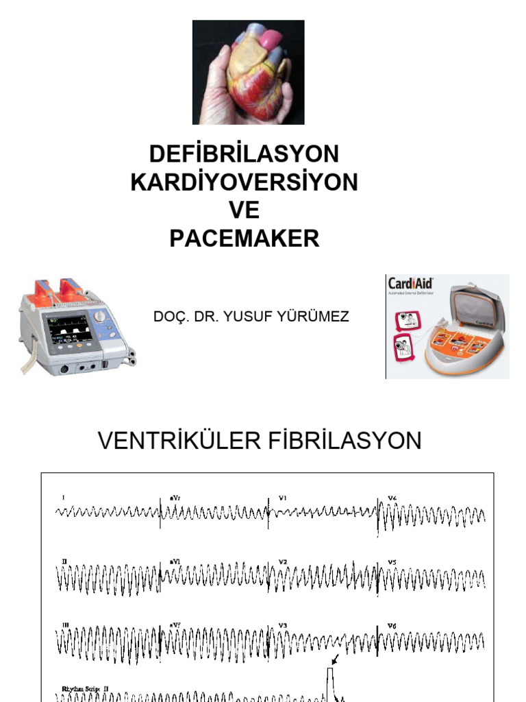 Defi̇bri̇lasyon Kardi̇yoversi̇yon Ve Pacemaker | PDF