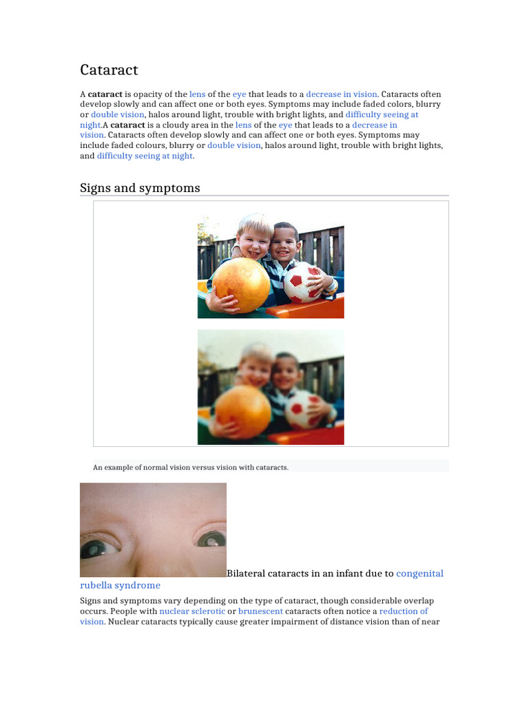 Cataract Notes For Medical Students | PDF | Cataract | Medical Specialties