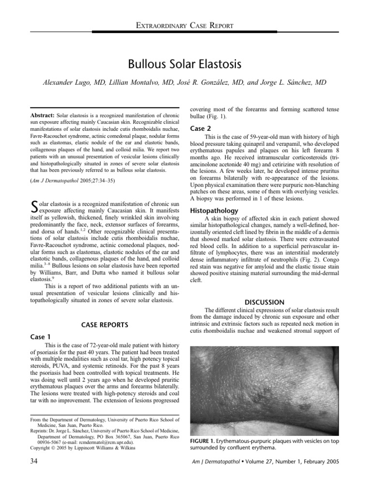Bullous Solar Elastosis Cases Report | PDF | Psoriasis | Diseases And ...