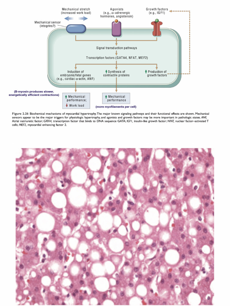 Cell Injury | PDF