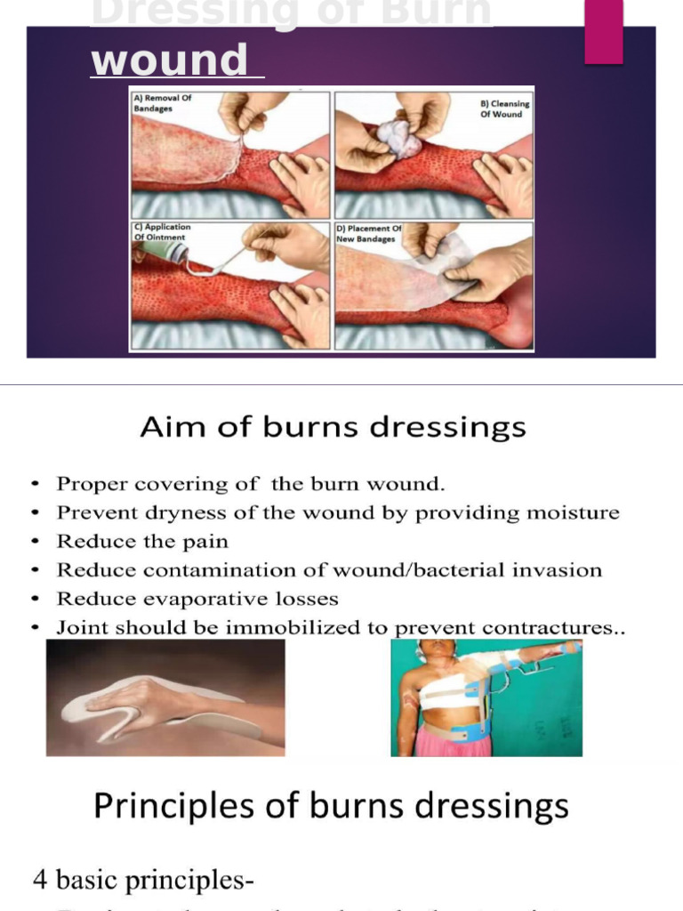 Dressing of Burn Wound | PDF