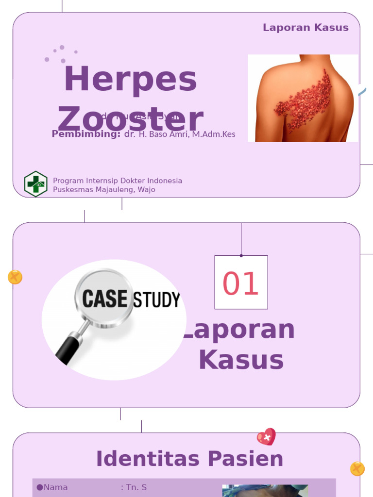 Laporan Kasus Parotitis | PDF