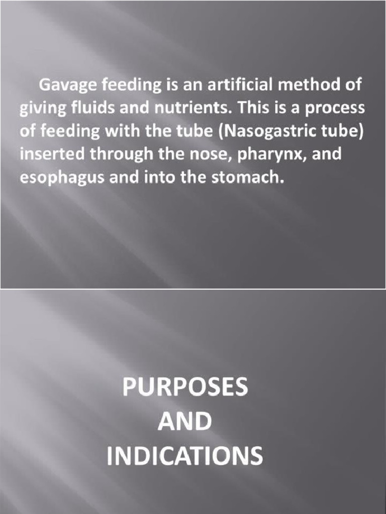 NG Tube Feeding | PDF
