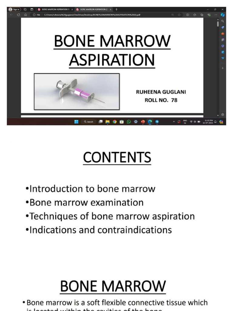 Bone Marrow Examination | PDF