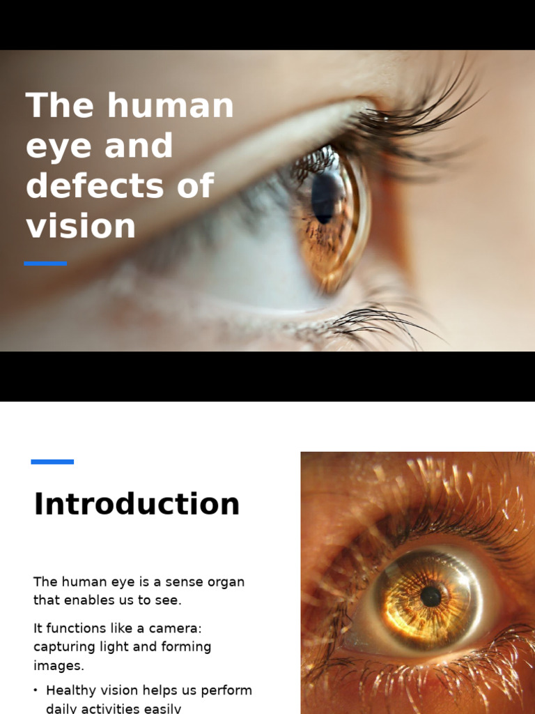 Understanding Eye Defects and Care | PDF