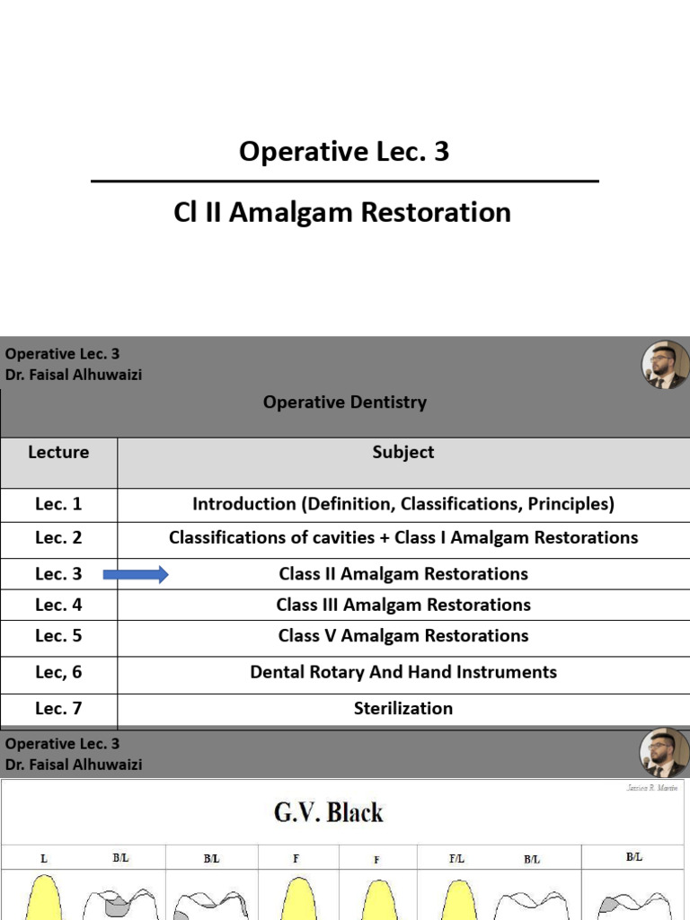 Operative Lec.3 CL II Amalgam. | PDF | Tooth Enamel | Dental Anatomy
