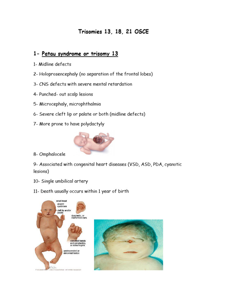 Understanding Trisomies 13, 18, 21 | PDF | Down Syndrome | Diseases And ...