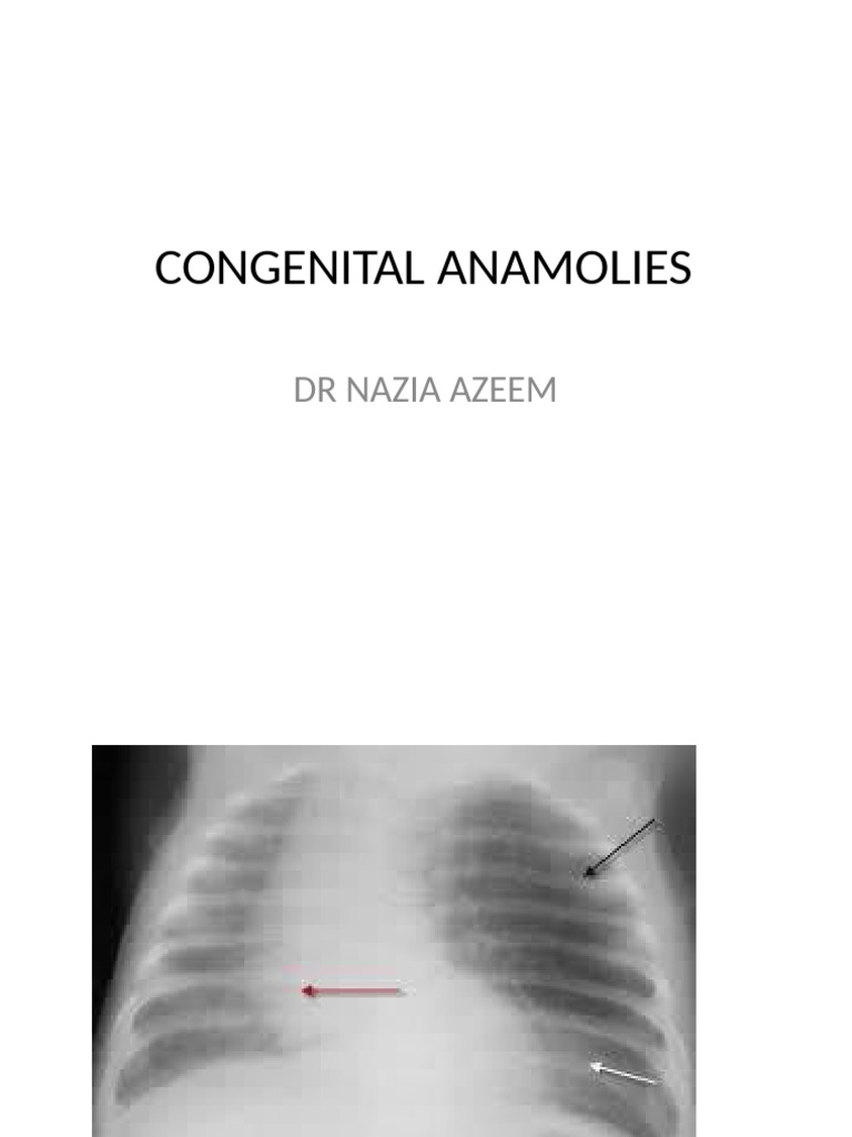 Congenital Anamolies | PDF