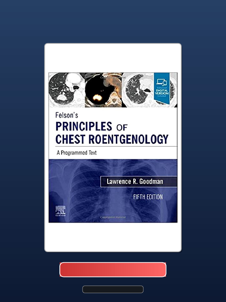 Test Bank For Testbank Felsons Principles of Chest Roentgenology ...
