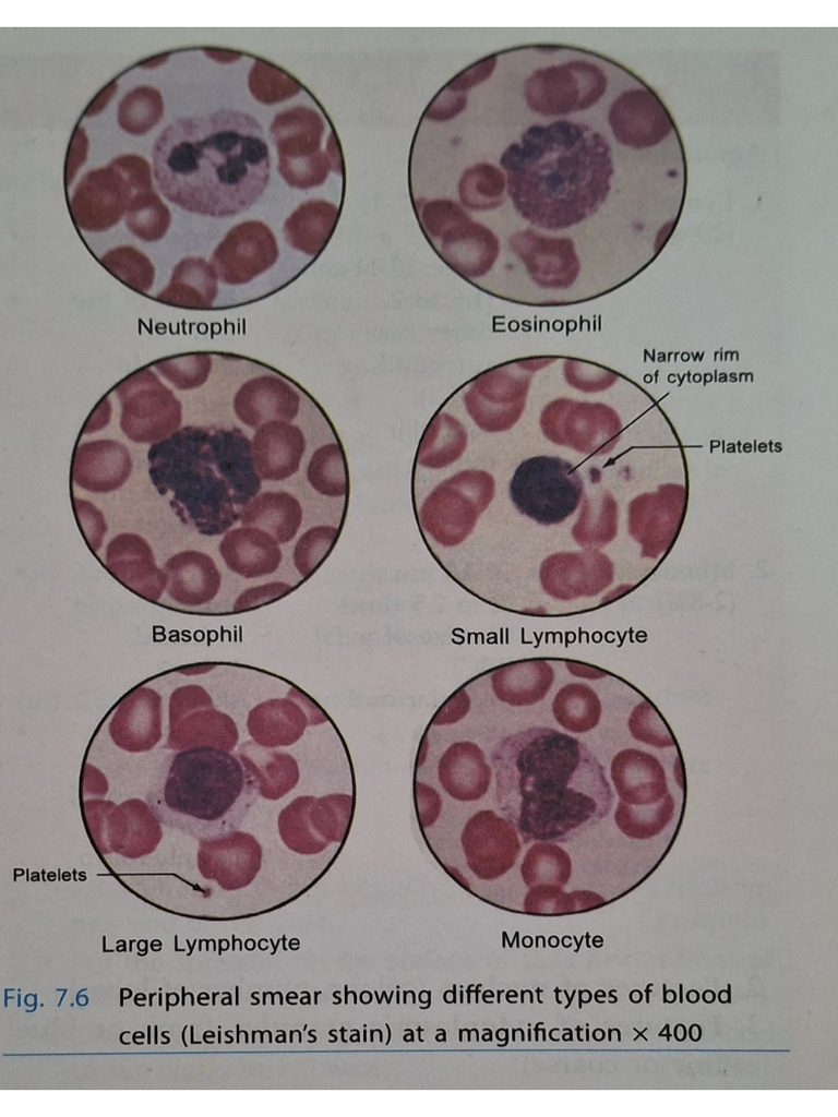 Diff WBC Count | PDF