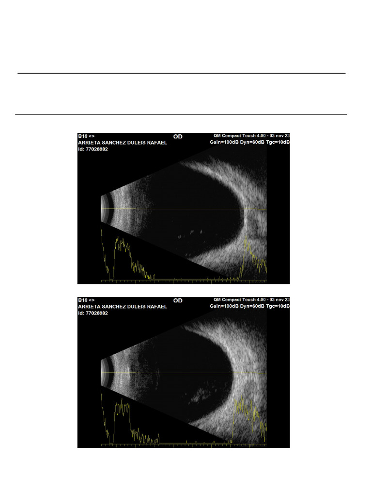 Ecografia - Arrieta Sanchez Duleis Rafael | PDF