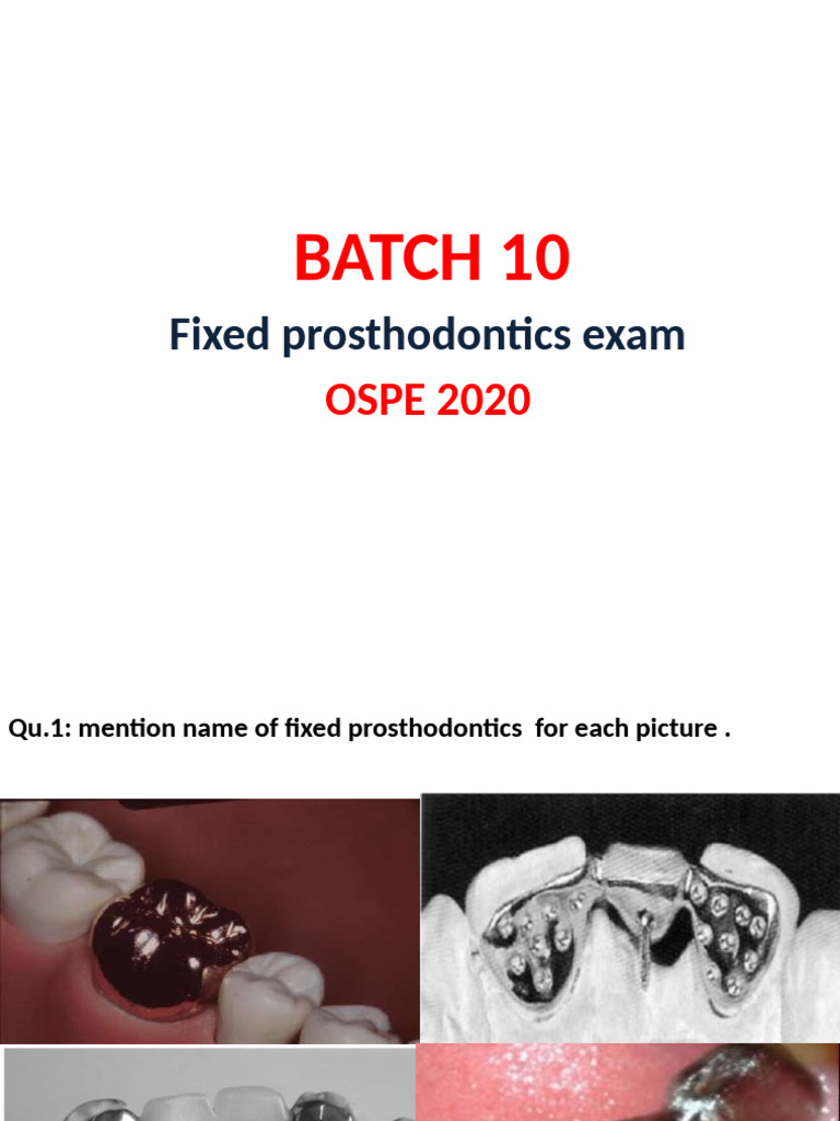 Fixed Ospe 2020 | PDF