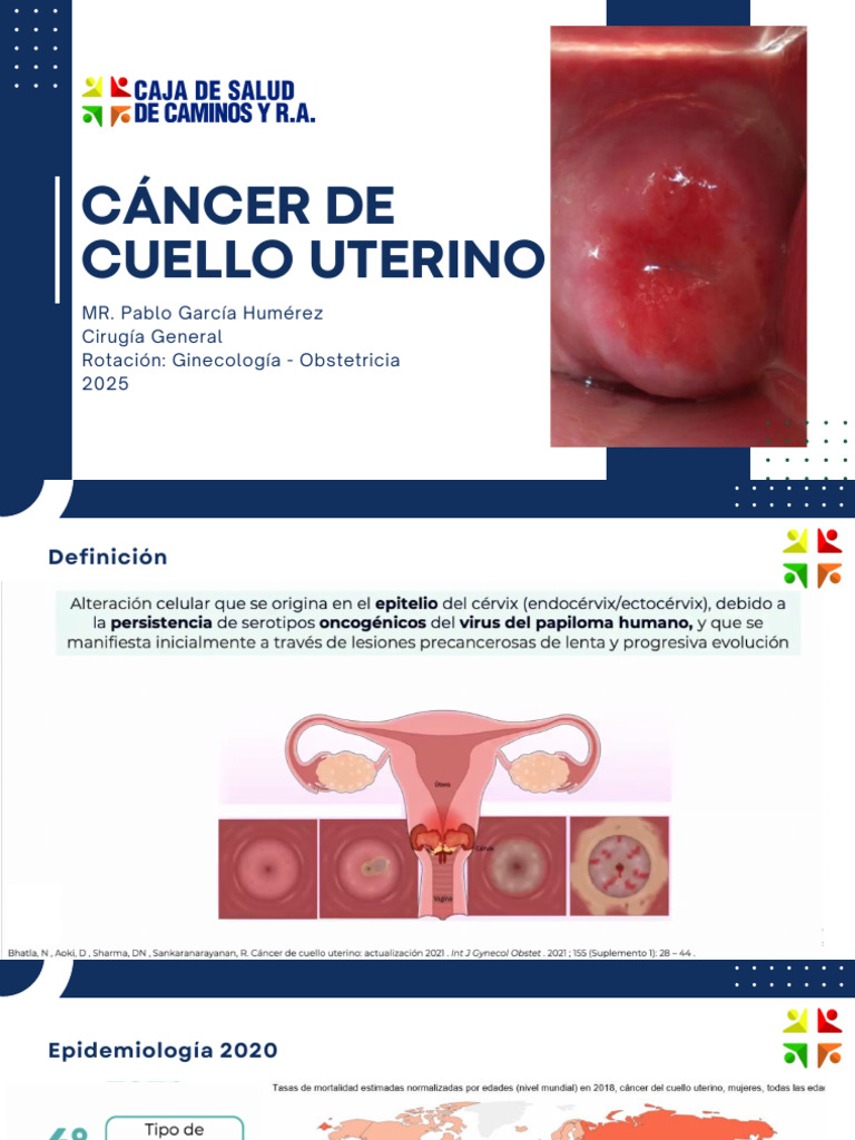 CA de cuello uterino | PDF