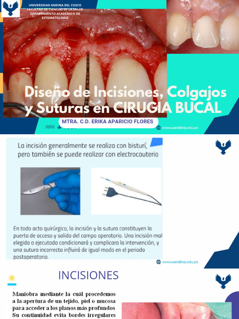 Diseño de Colgajos en Cirugía Bucal | PDF