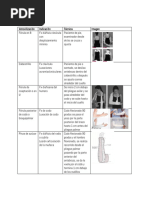 Tipos de férulas y sus indicaciones | PDF | Codo | Tobillo