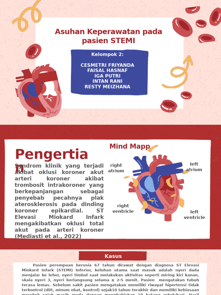 Stemi | PDF
