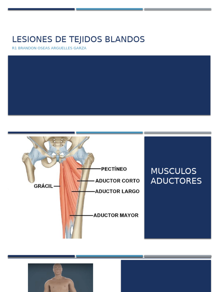 Tendinitis de Aductores: Síntomas y Diagnóstico | PDF | Sistema ...