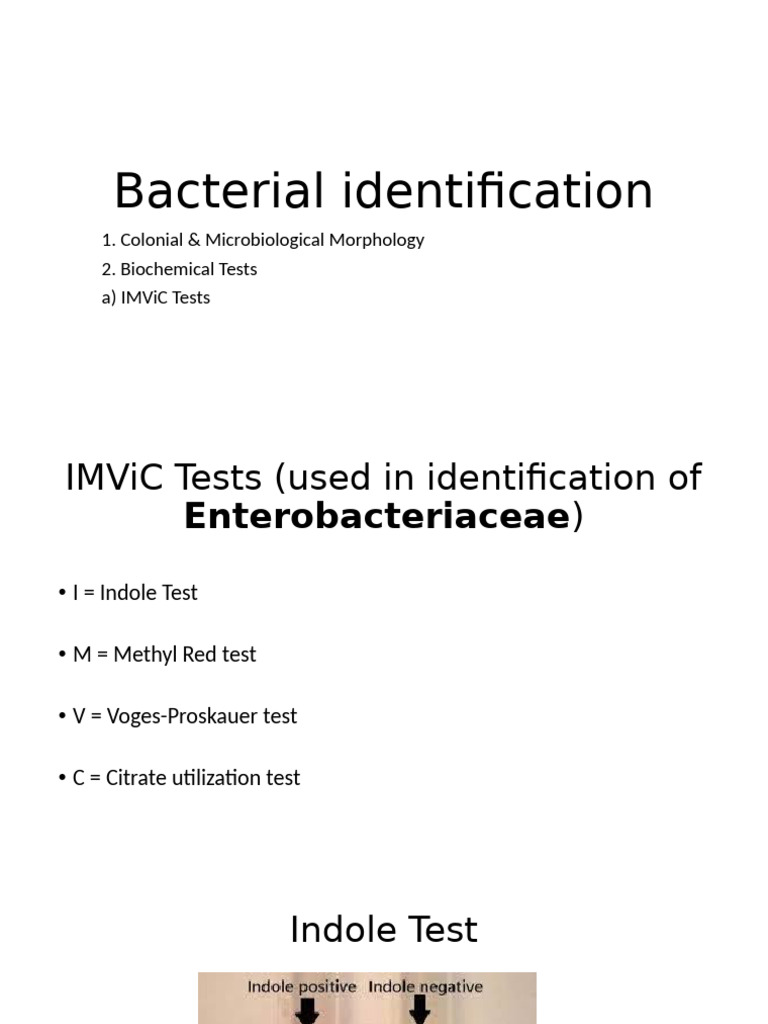 Bacterial Identification (IMViC Test) | PDF