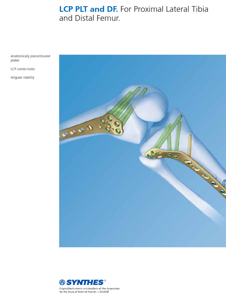 LCP Plates for Tibia and Distal Femur | PDF | Screw | Drill