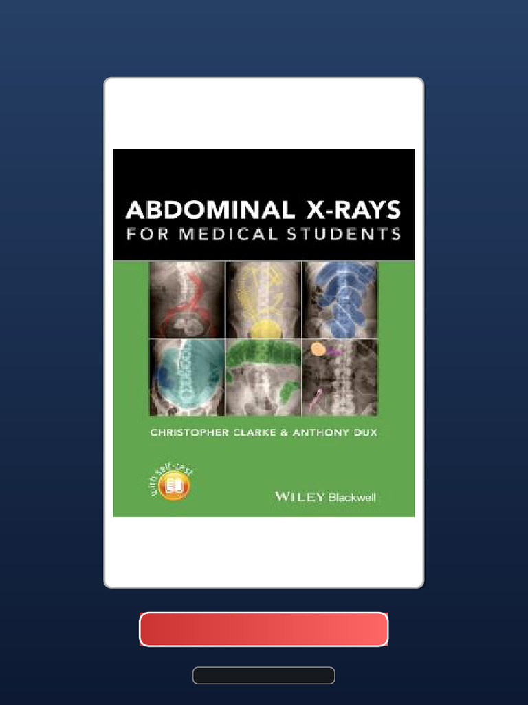 Abdominal Xrays For Medical Students Full Download | PDF | Science | Information