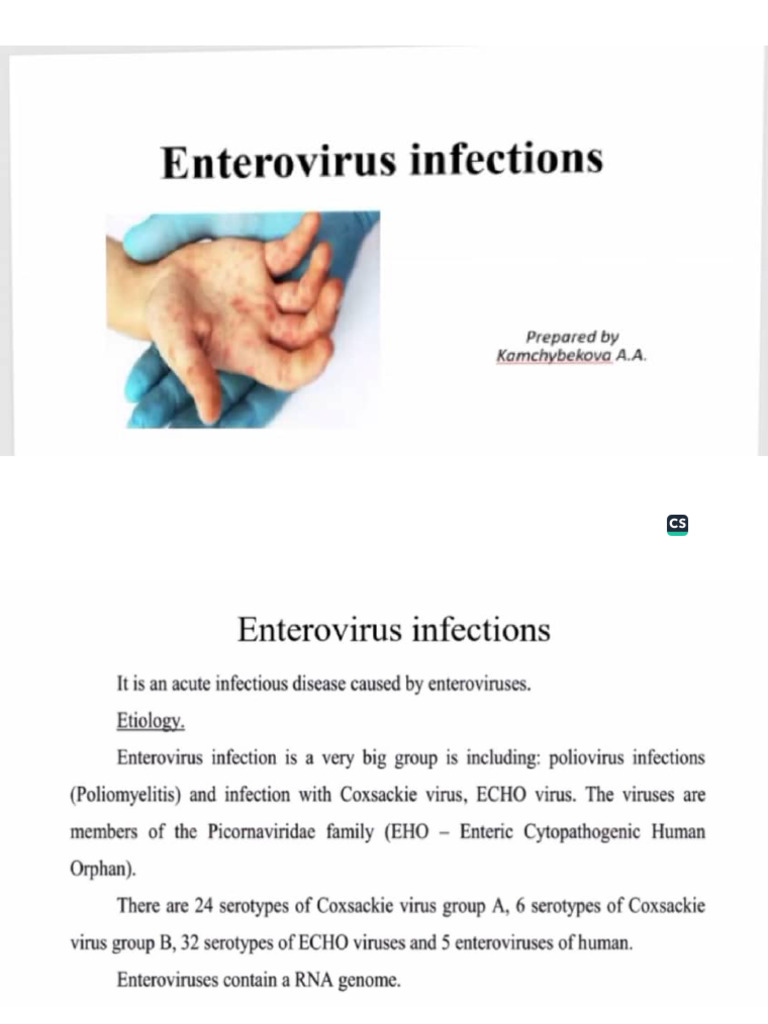 Enterovirus Infections | PDF