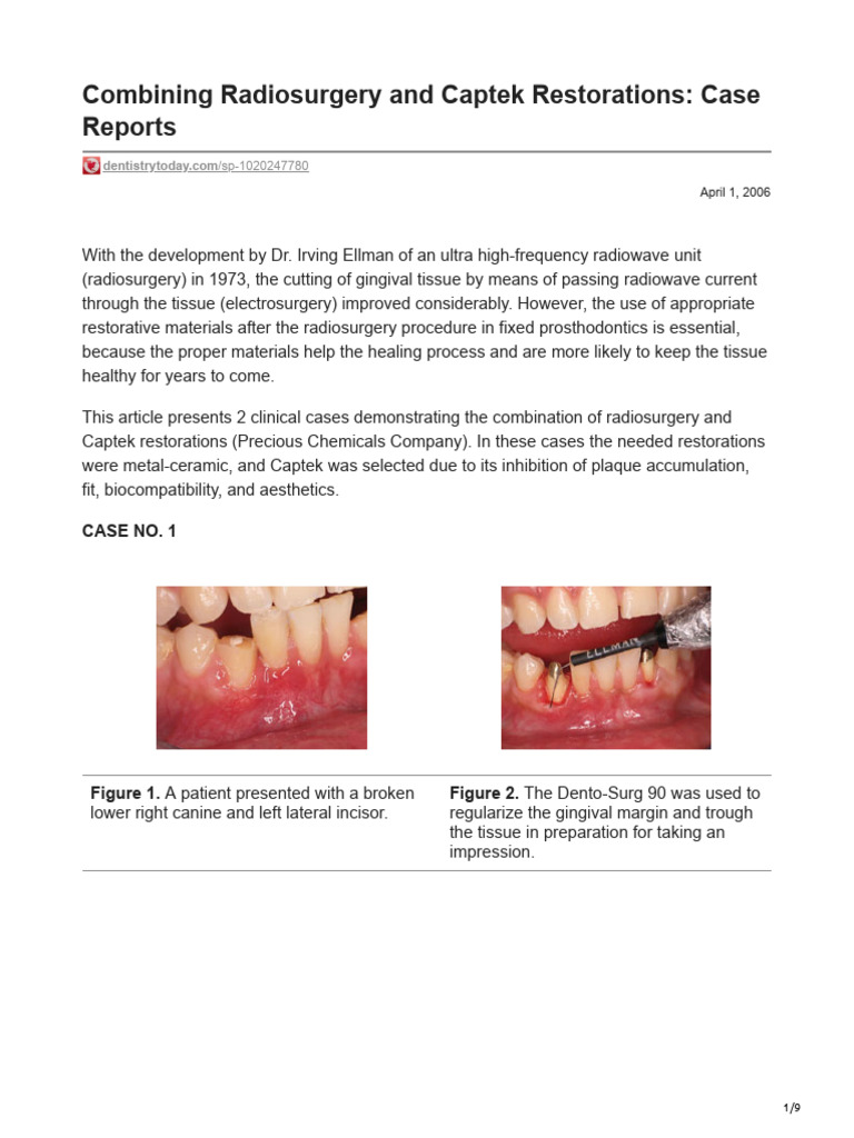Combining Radiosurgery and Captek Restorations Case Reports | PDF ...